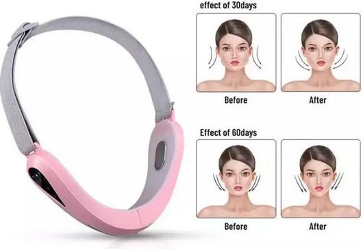 Συσκευή Μασάζ Shape Delicate V Face για το Κεφάλι με Δόνηση | SHOPFLIX.gr